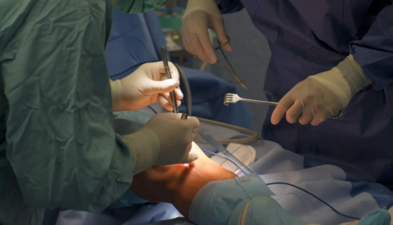 Knee Replacement | Total Knee Replacement